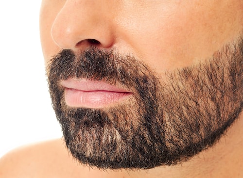 Information About Beard To Scalp Hair Transplant | Cosmetic Town
