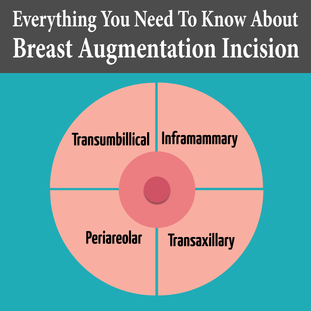 Variety Of Breast Augmentation Incisions Cosmetic Town